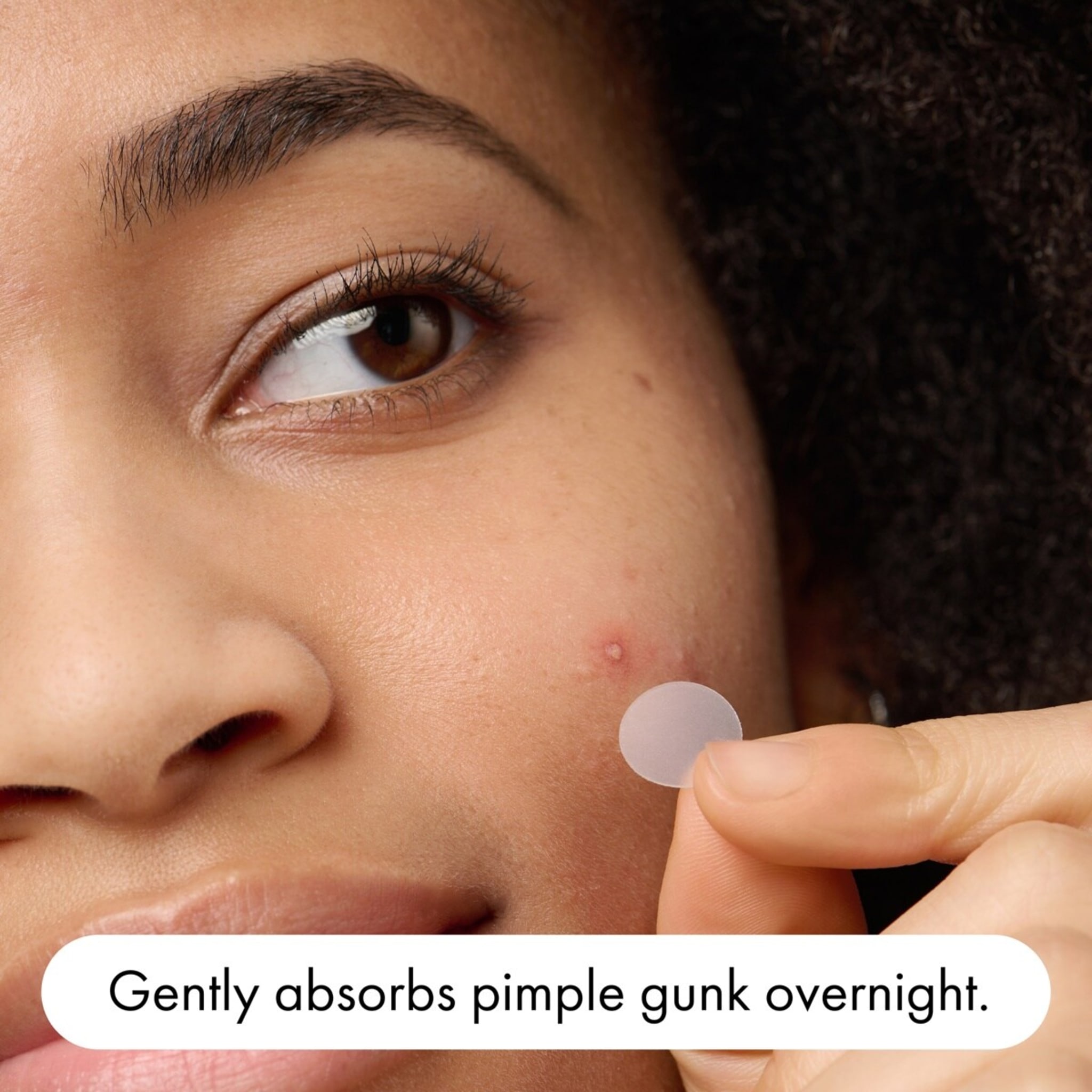 Hero 24 Pack Mighty Patch The Original Pimple Patches - Hydrocolloid ...