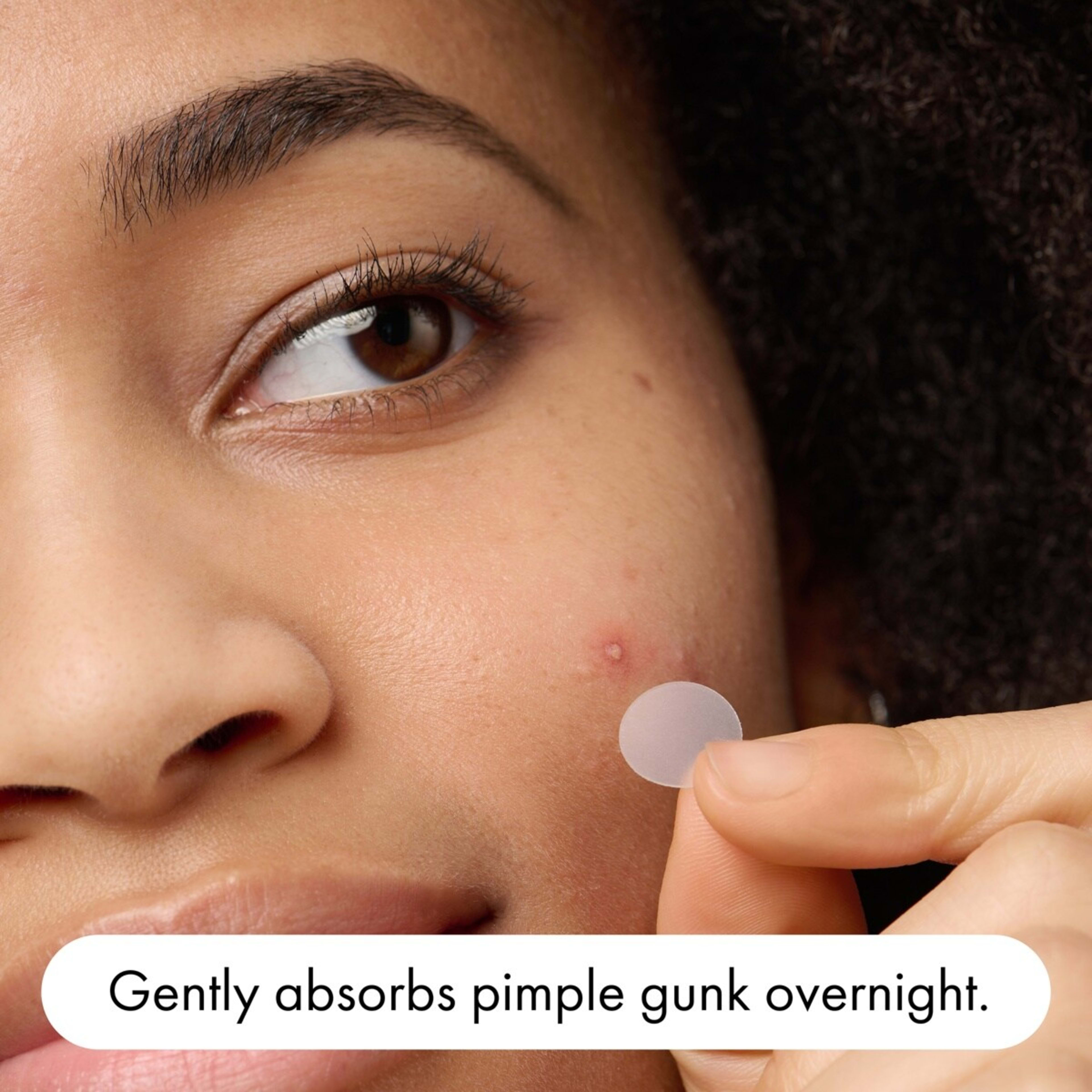 Hero 24 Pack Mighty Patch The Original Pimple Patches - Hydrocolloid ...